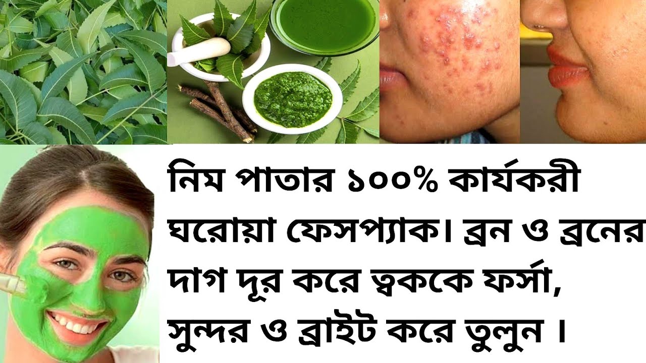 নিমপাতা দিয়ে ব্রণ দূর করে ত্বককে ফর্সা ও দাগমুক্ত করার ১০০ কার্যকরী ঘরোয়া ফেসপ্যাকneem