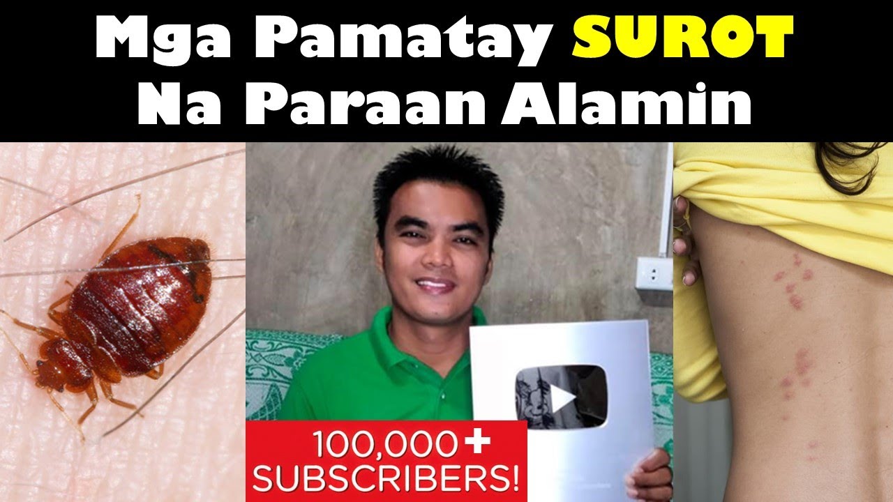 Pamatay surot na mga paraan na dapat mong malaman - YouTube