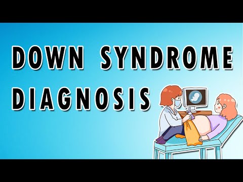 Prenatal Diagnosis of Down Syndrome