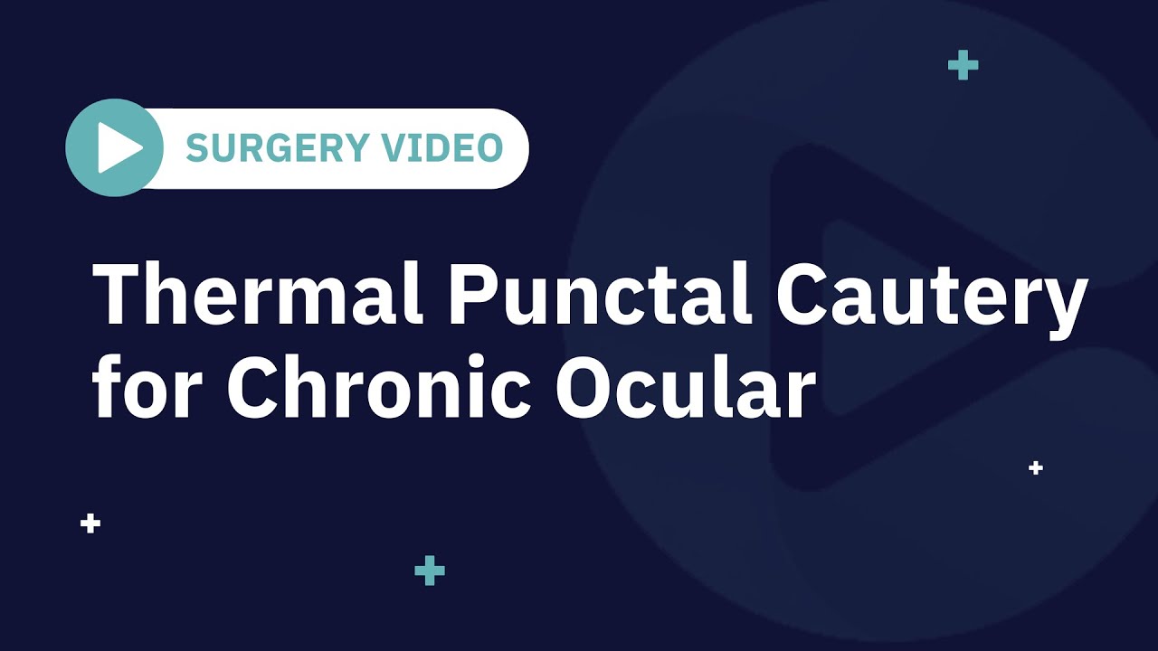 Surgery Video: Thermal Punctal Cautery for Chronic Ocular Surface ...