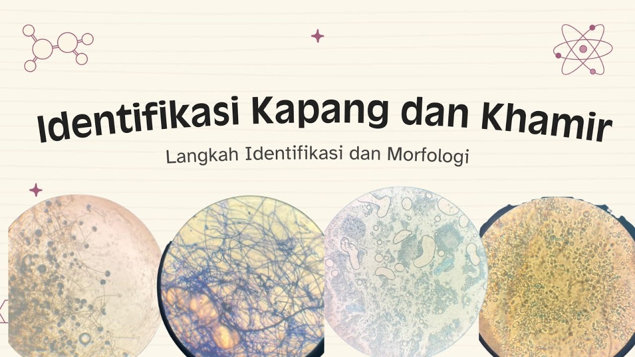 PRAKTIKUM ISOLASI SERTA IDENTIFIKASI MORFOLOGI KHAMIR DAN KAPANG - YouTube