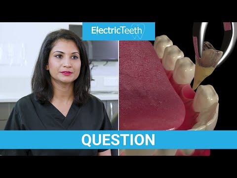 How To Encourage Blood Clot After Tooth Extraction