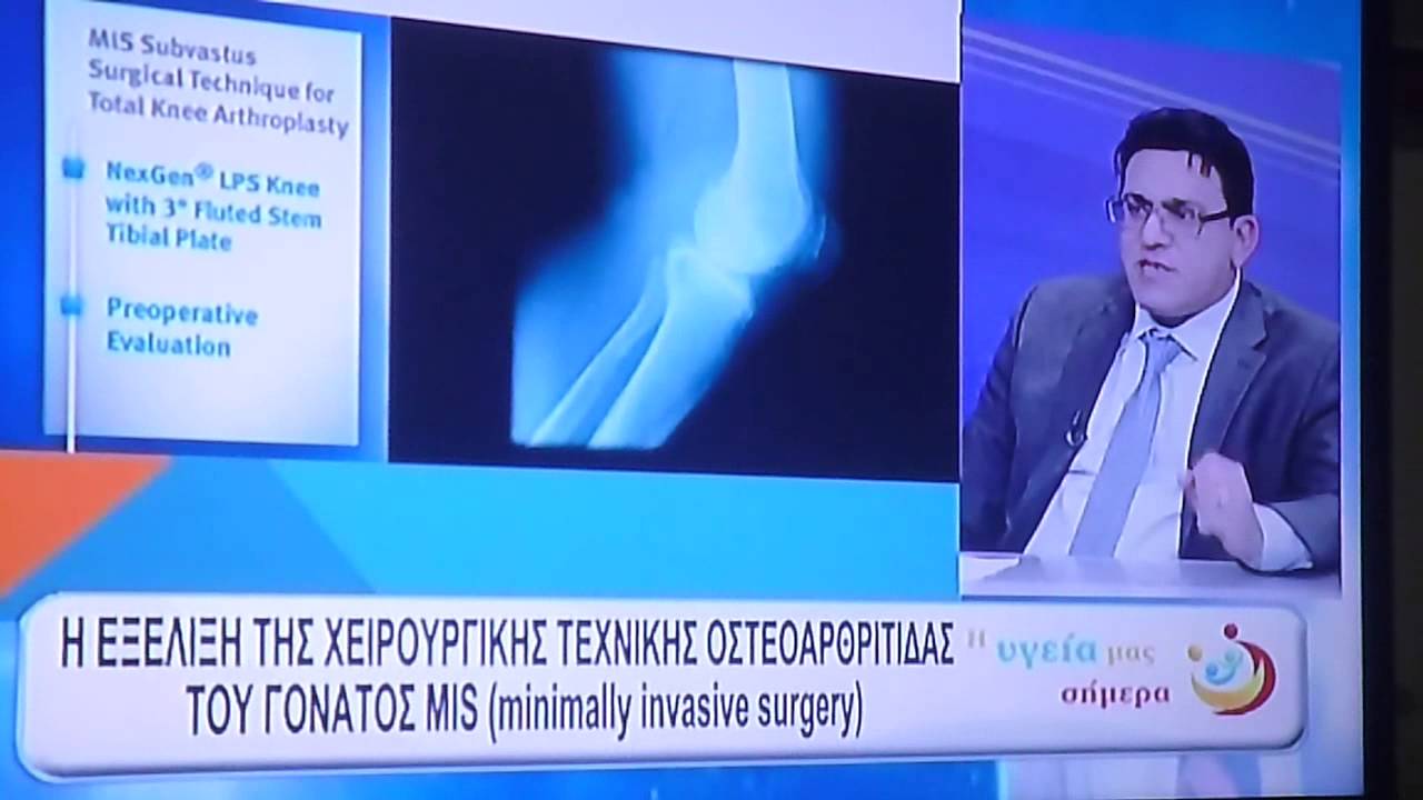 ΟΣΤΕΟΑΡΘΡΙΤΙΔΑ για ΓΟΝΑΤΟ P1120746 - YouTube