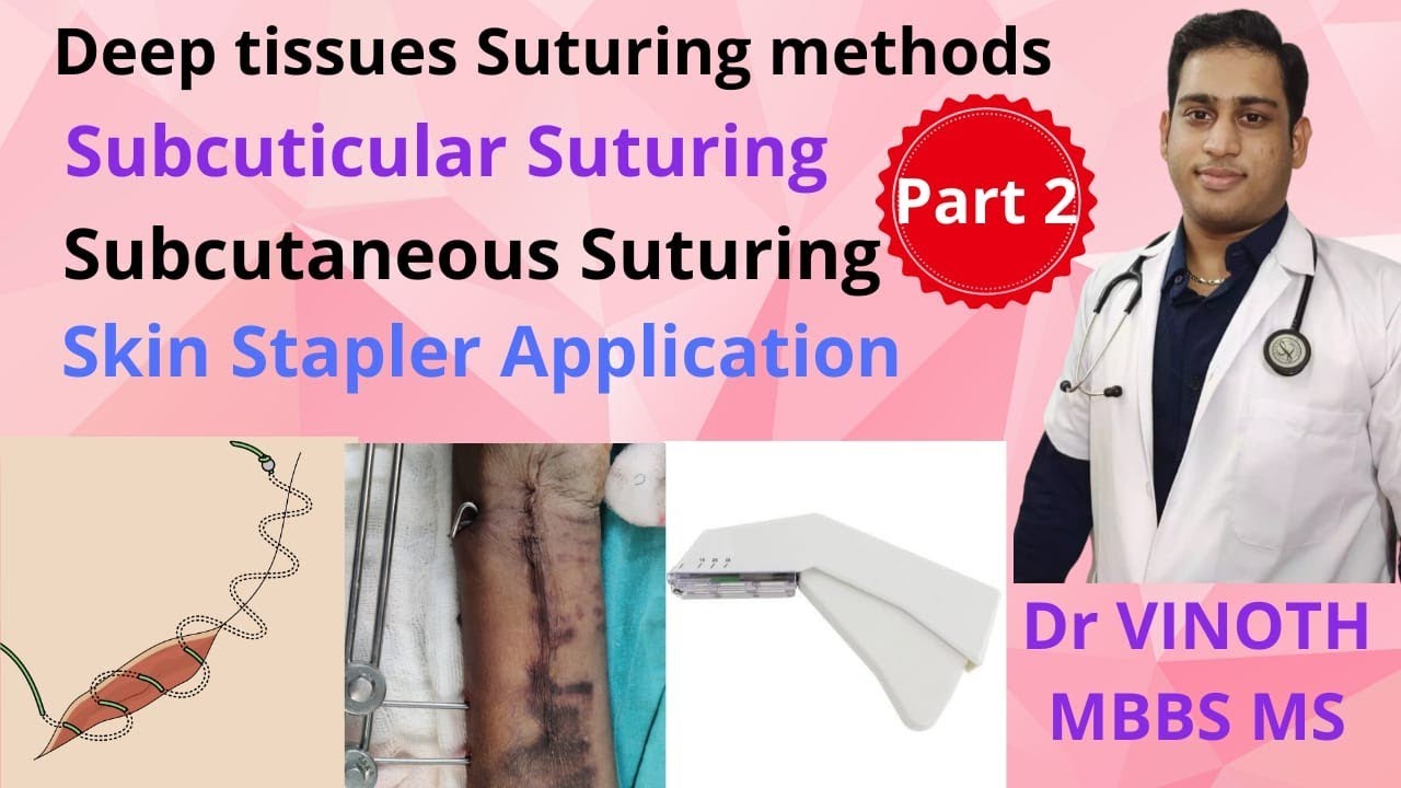 Suturing Techniques | How Subcutaneous suturing is done ? | Minimal ...