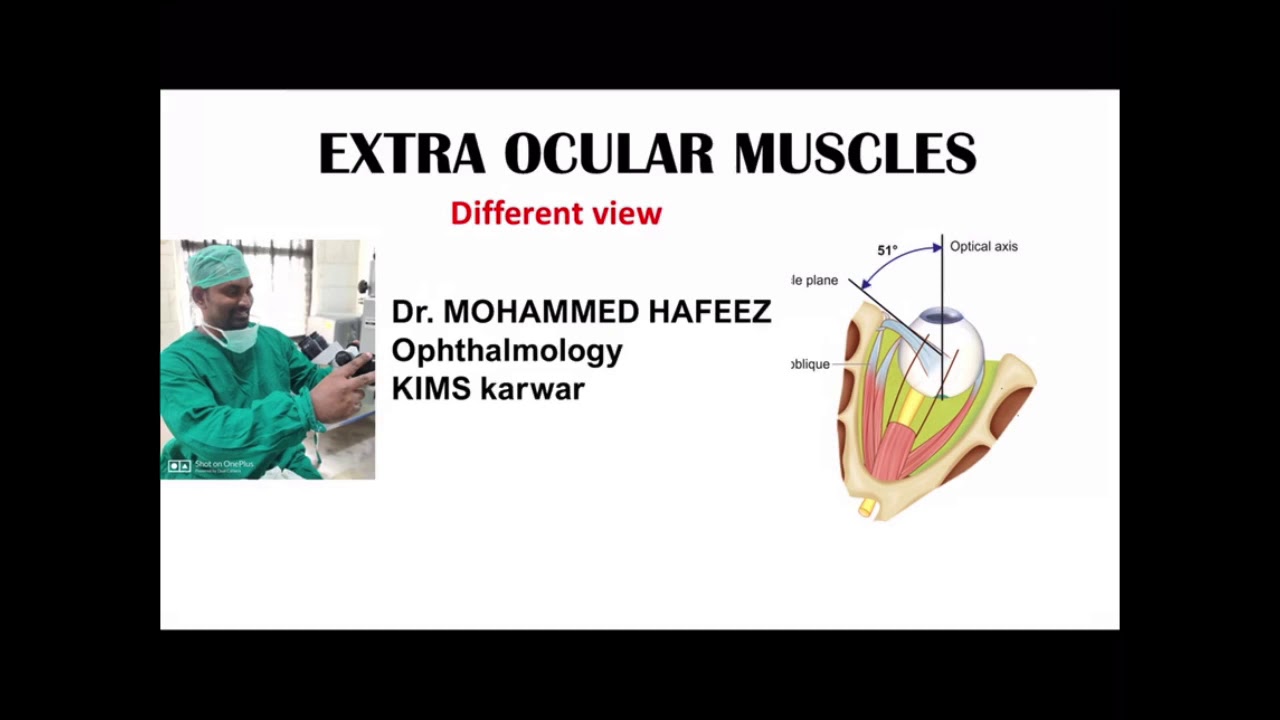 Extra ocular muscles | squint | strabismus | DIFFERENT perspective ...