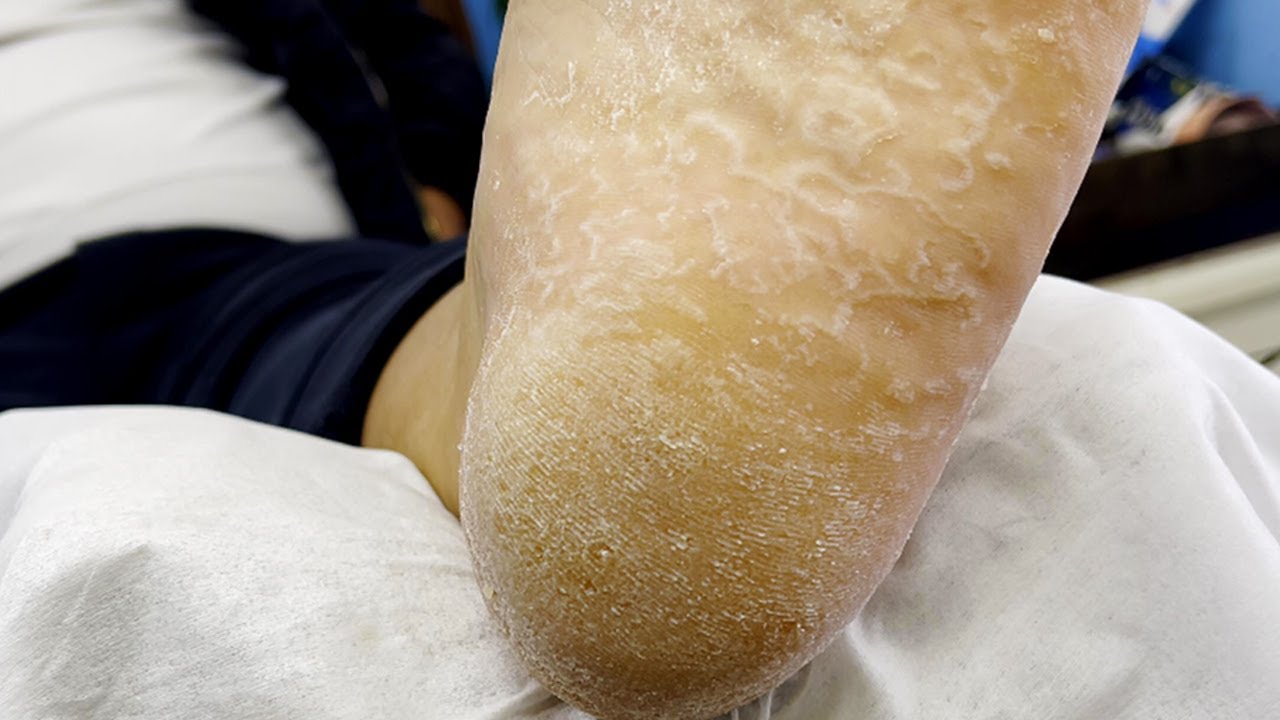 Pedicure Tutorial：The calluses of the feet are ground into patterns ...