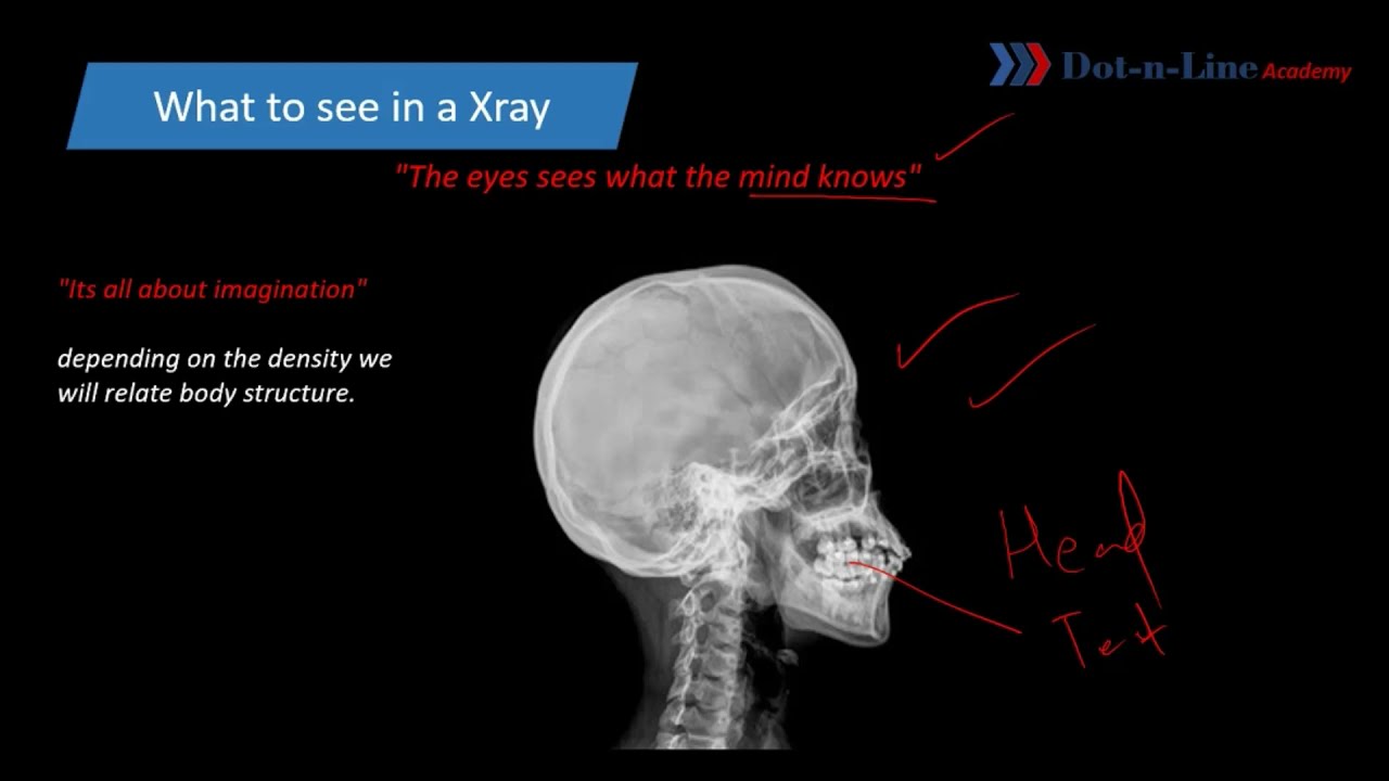 All about XRAYS | What is X-Ray | How X Rays are formed | How to see a ...