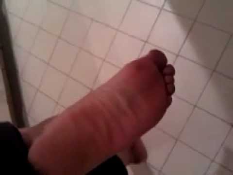 My Redbone Feet