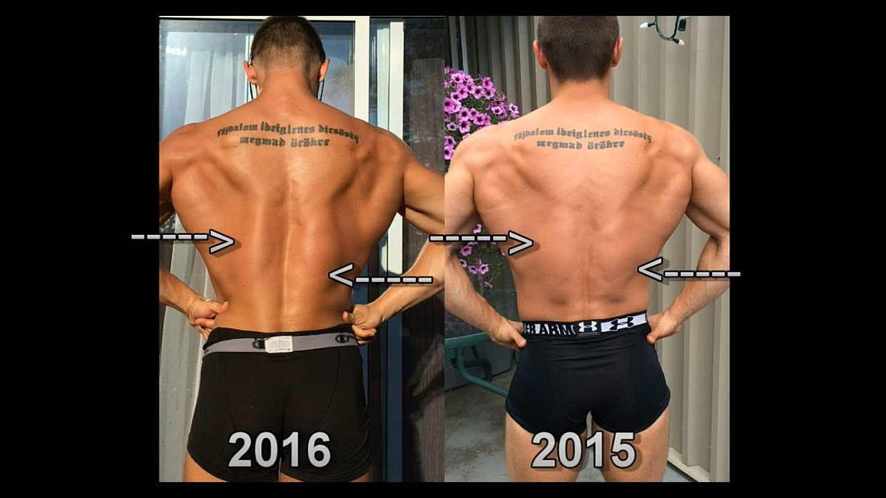 Fixing My Posture & WeakPoints - 1 YEAR TRANSFORMATION | Intermittent ...