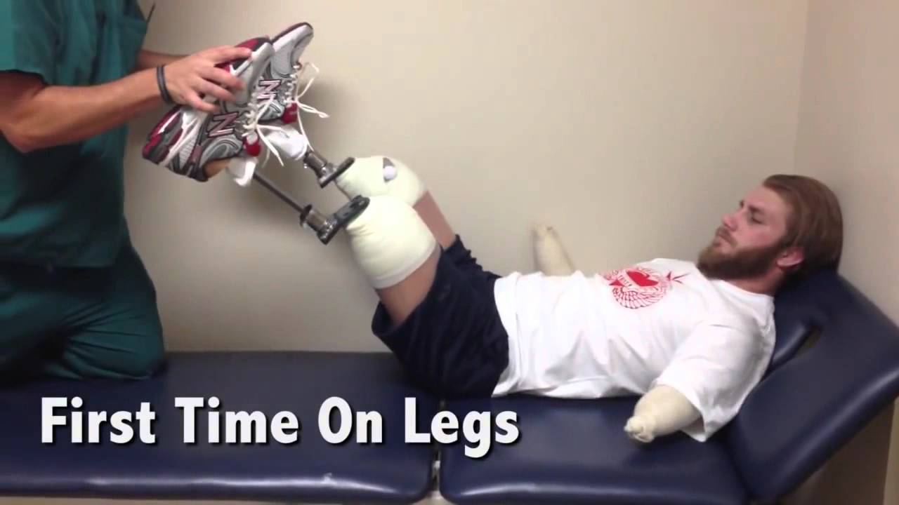 UNSTOPPABLE A Quad Amputee Story - YouTube