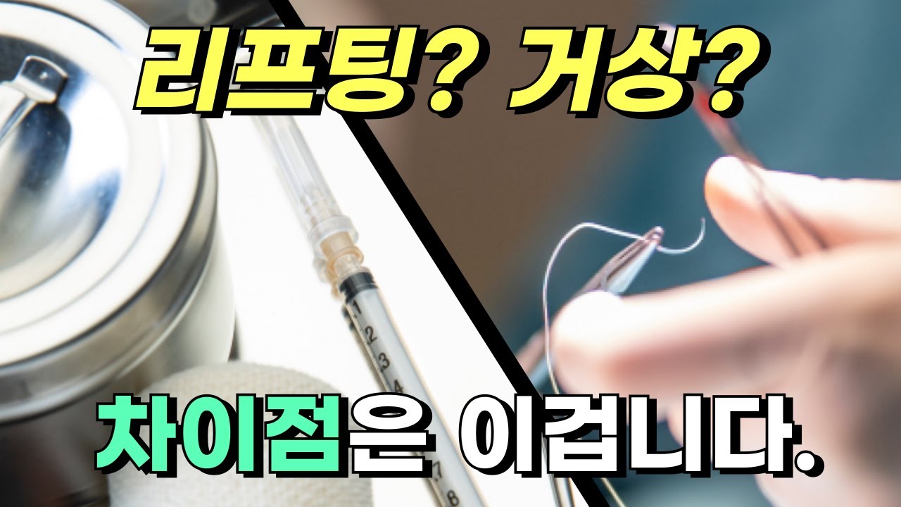 리프팅시술 리프팅 Vs 거상 차이점은 이것 ㅣ부산 리프팅 성형외과 Youtube