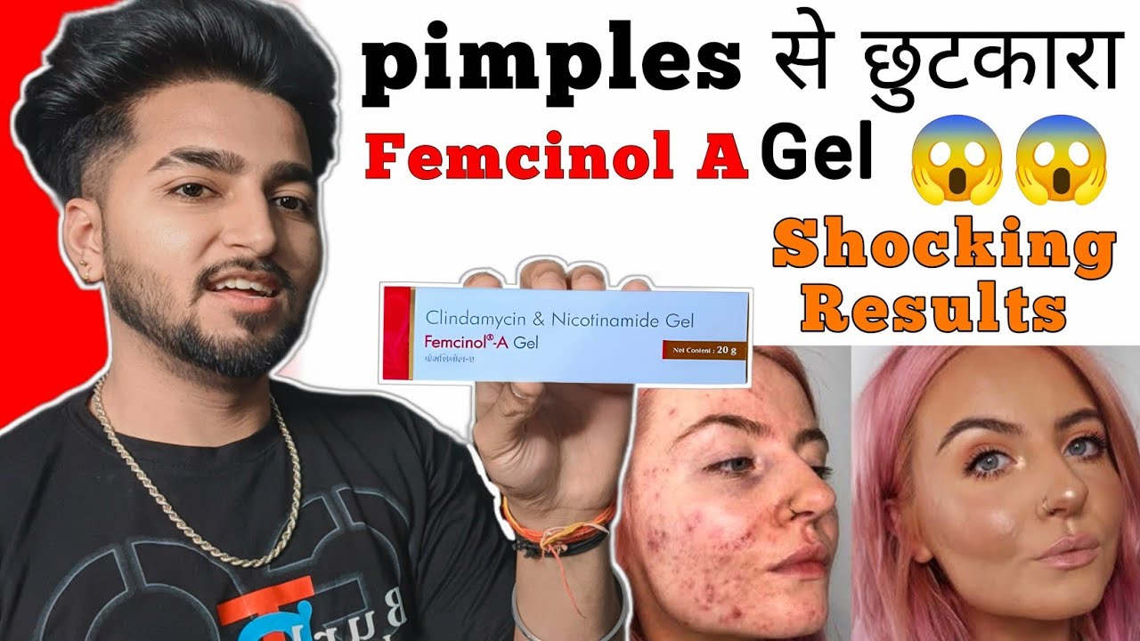 Femcinol A Gel Complete Information | Femcinol A Gel Review | How to ...