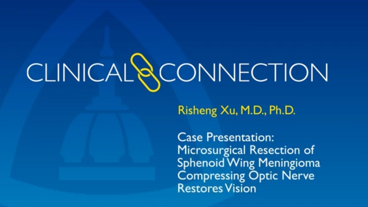 Case Presentation: Microsurgical Resection of Sphenoid Wing Meningioma ...