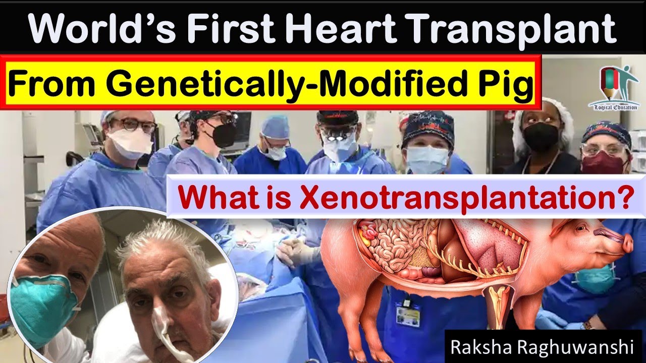 World’s First Heart Transplant From Genetically Modified Pig | Organ ...