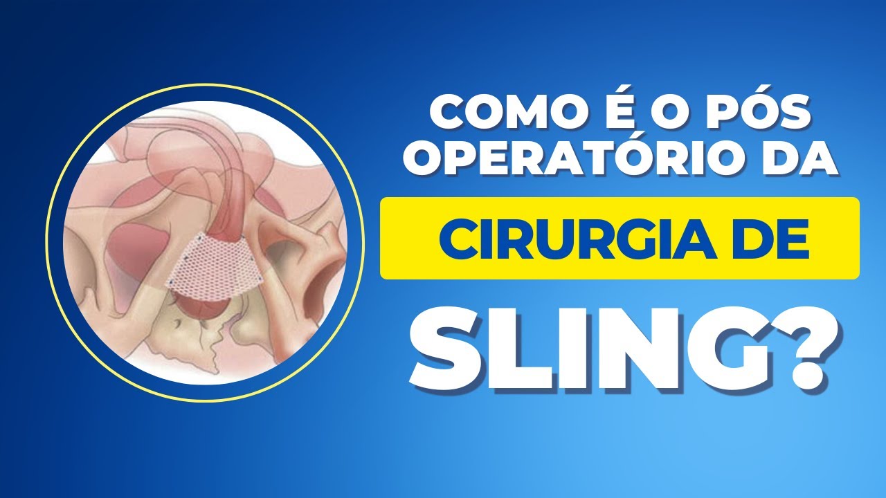 Como é o pós operatório da cirurgia de sling? - YouTube