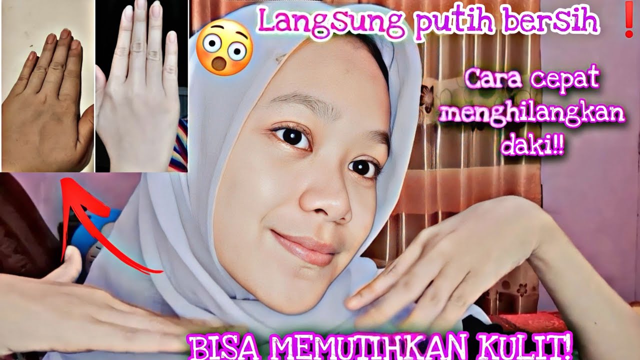 CARA CEPAT MENGHILANGKAN DAKI HANYA DENGAN BUBUK KOPI + PEMUTIH BADAN ...