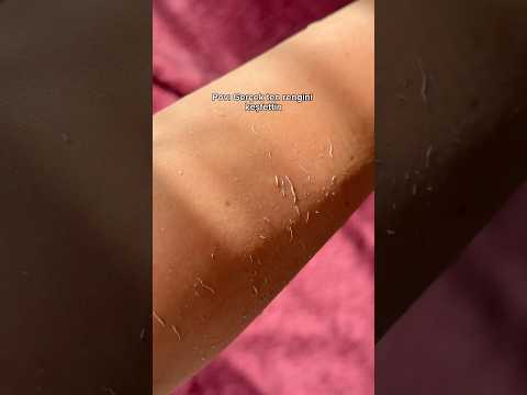 Silgi gibi çıkan derime bakın🤭 #shorts reklam