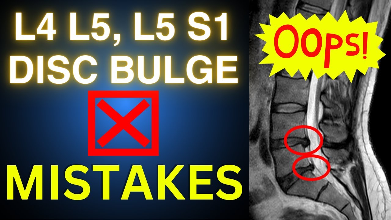 5 Common Mistakes in L4-L5 Disc Bulge Recovery and How to Avoid Them ...