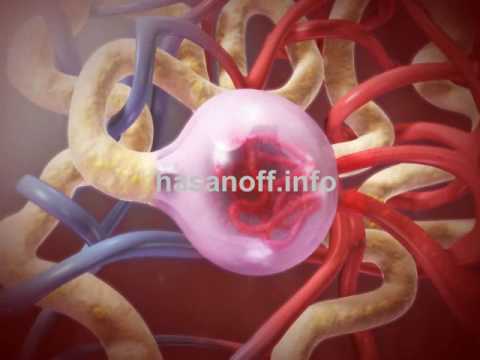 İfrazat sistemi\\Urinary System