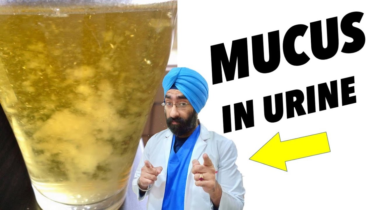 Mucus In Urine Dr Education YouTube mucus-in-urine-dr-education-youtube