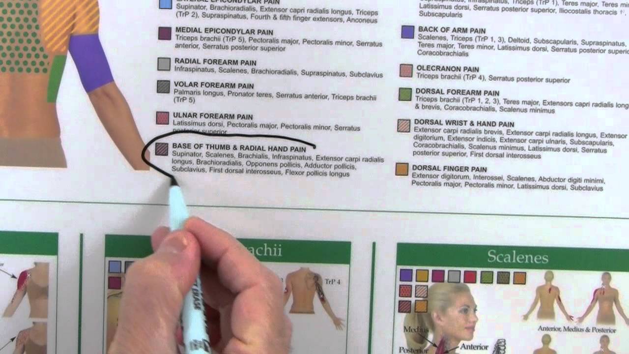 Upper Extremity Trigger Point Wall Chart - YouTube