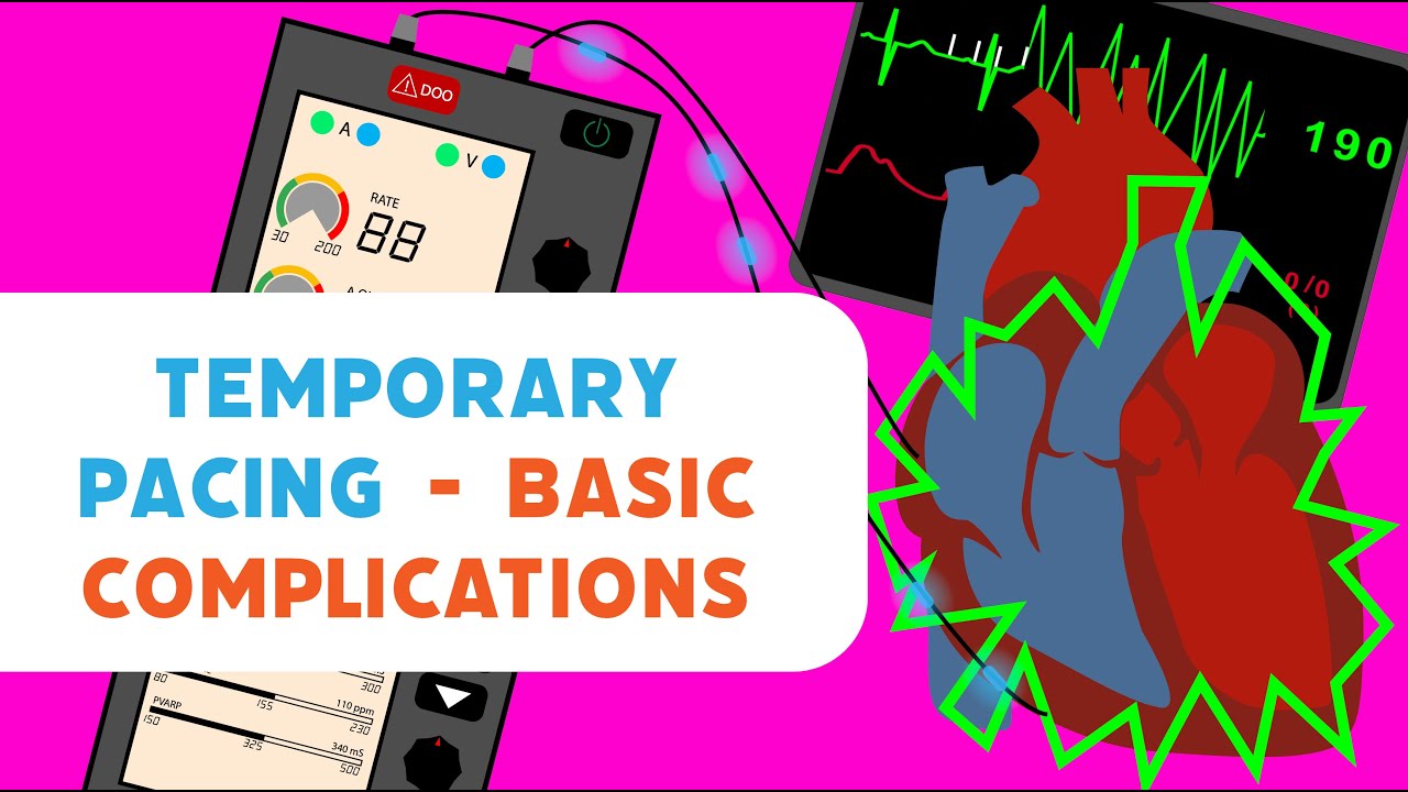 Temporary Pacing Basic Complications - YouTube