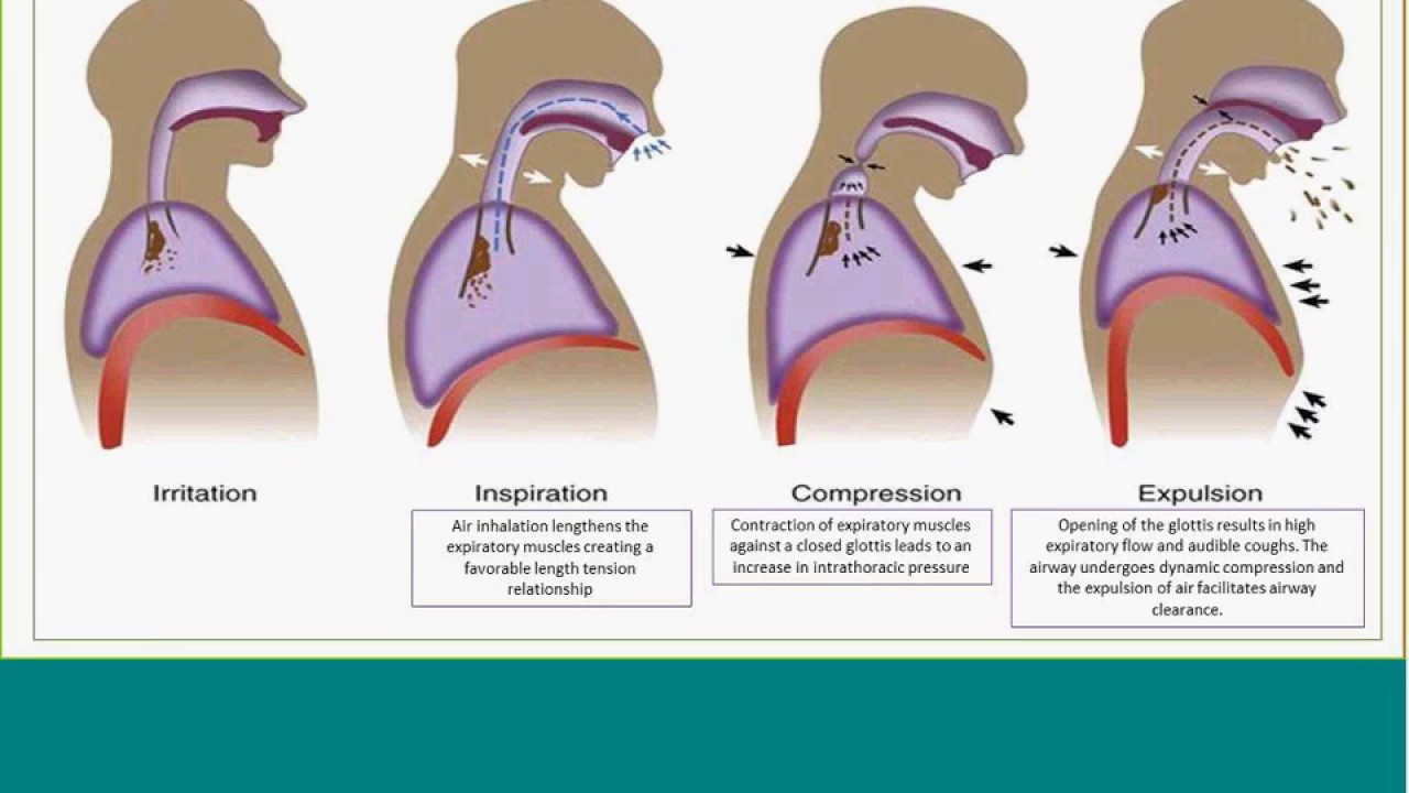 Chronic Cough - YouTube