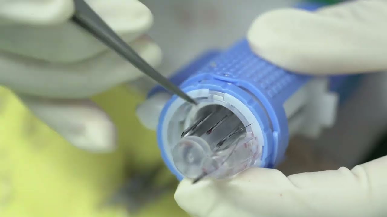 [INRUT] Multi Implanter - Loading method - YouTube