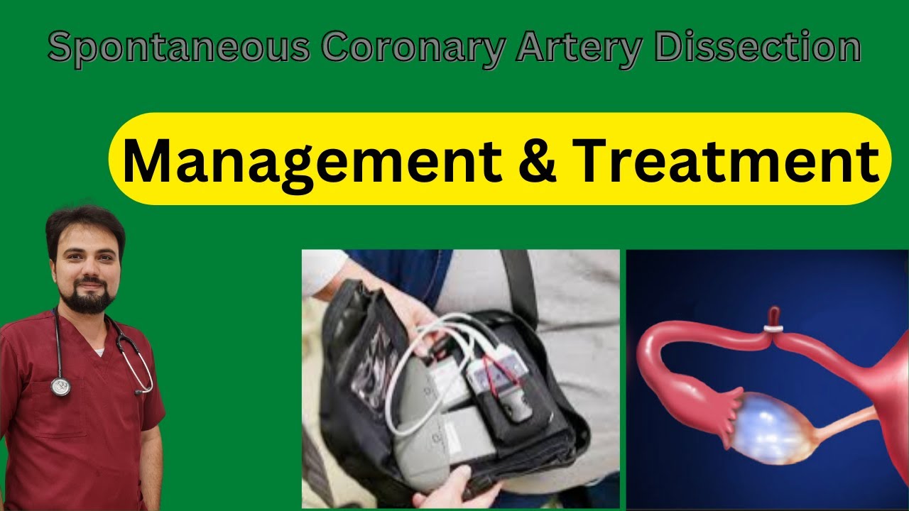 SCAD Management: What You Need to Know - YouTube