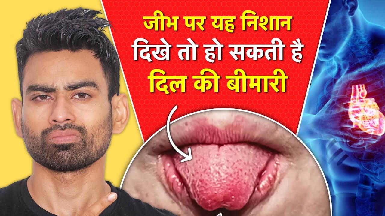 जीभ से जाने सेहत का हाल What Tongue Says About Your Health Youtube