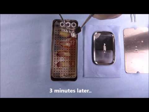 Process for PRF by Dr.Joseph Choukroun - YouTube