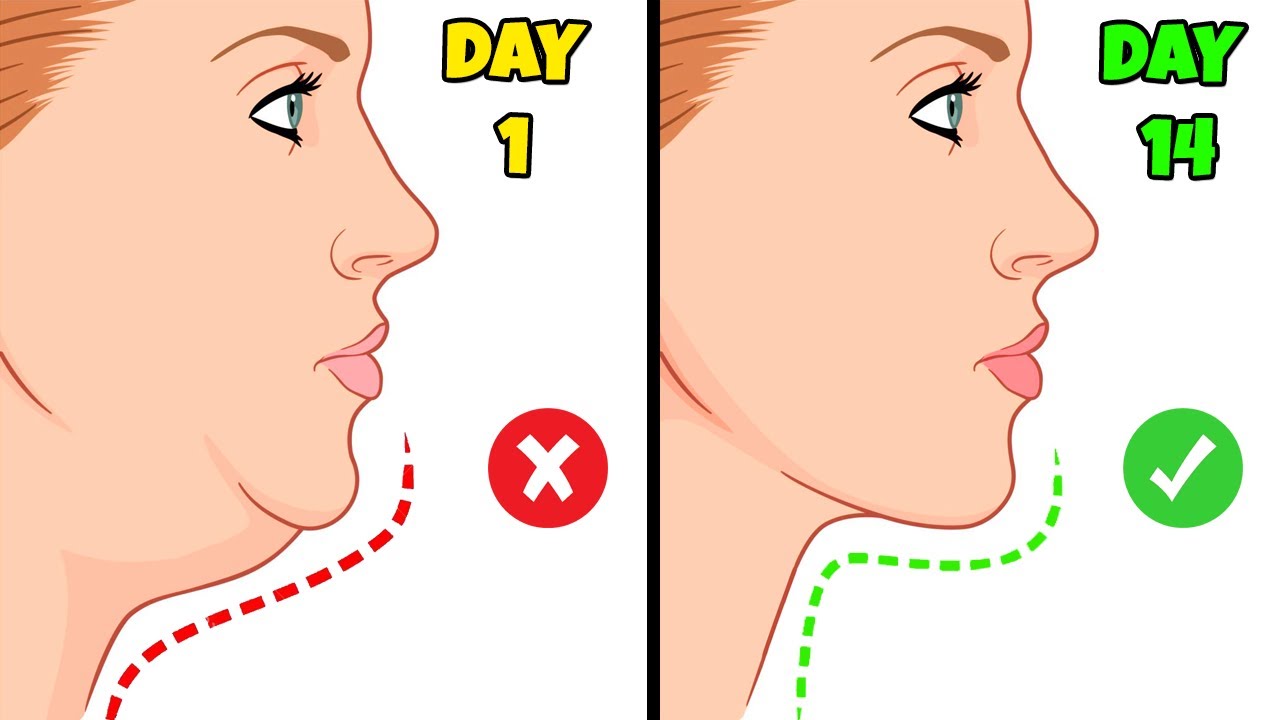 5 Min, 5 Facial Exercises to Get Rid of DOUBLE CHIN & FACE FAT - YouTube