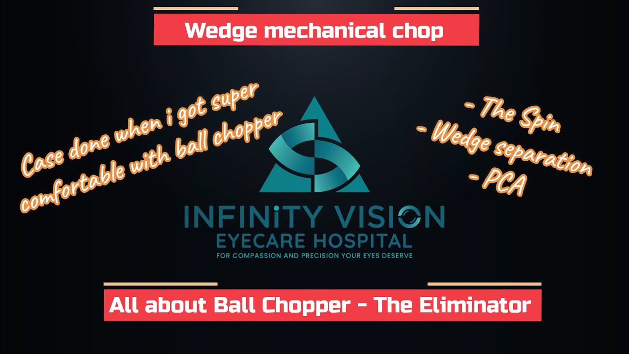 Wedge mechanical separation - Ball Chopper - Phacoemulsification: Dr ...