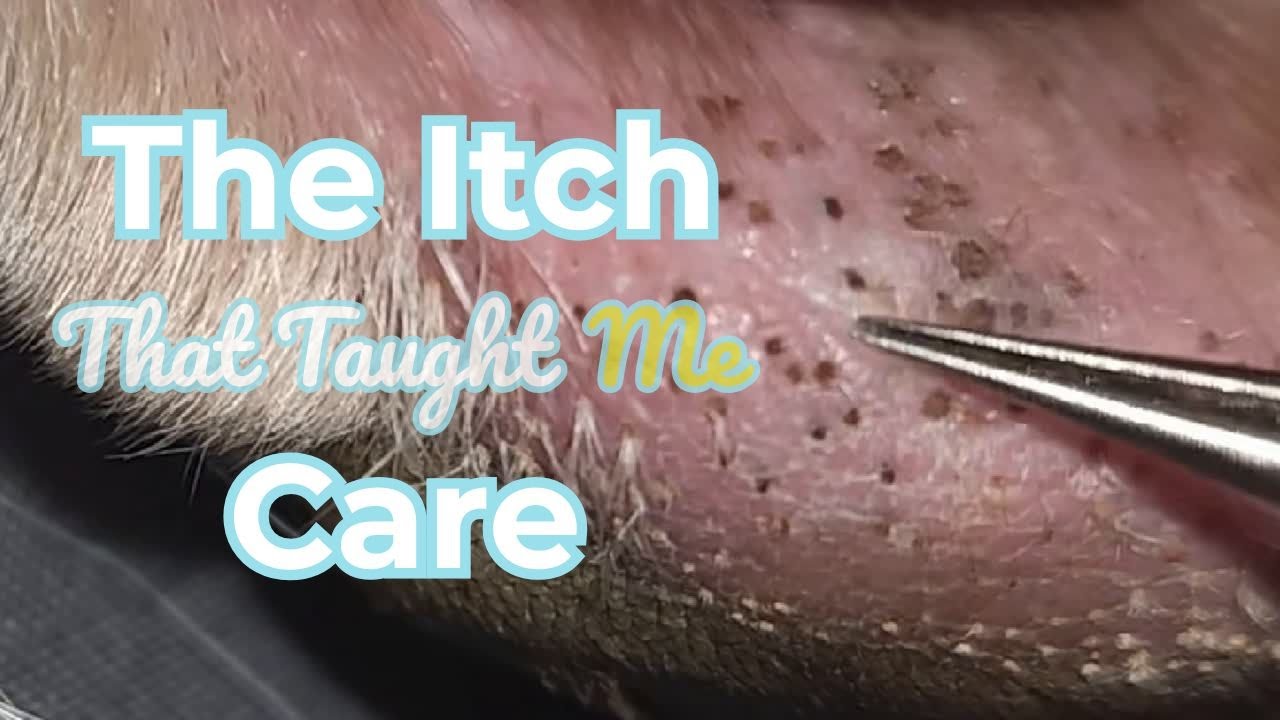 The Itch That Taught Me Care - YouTube