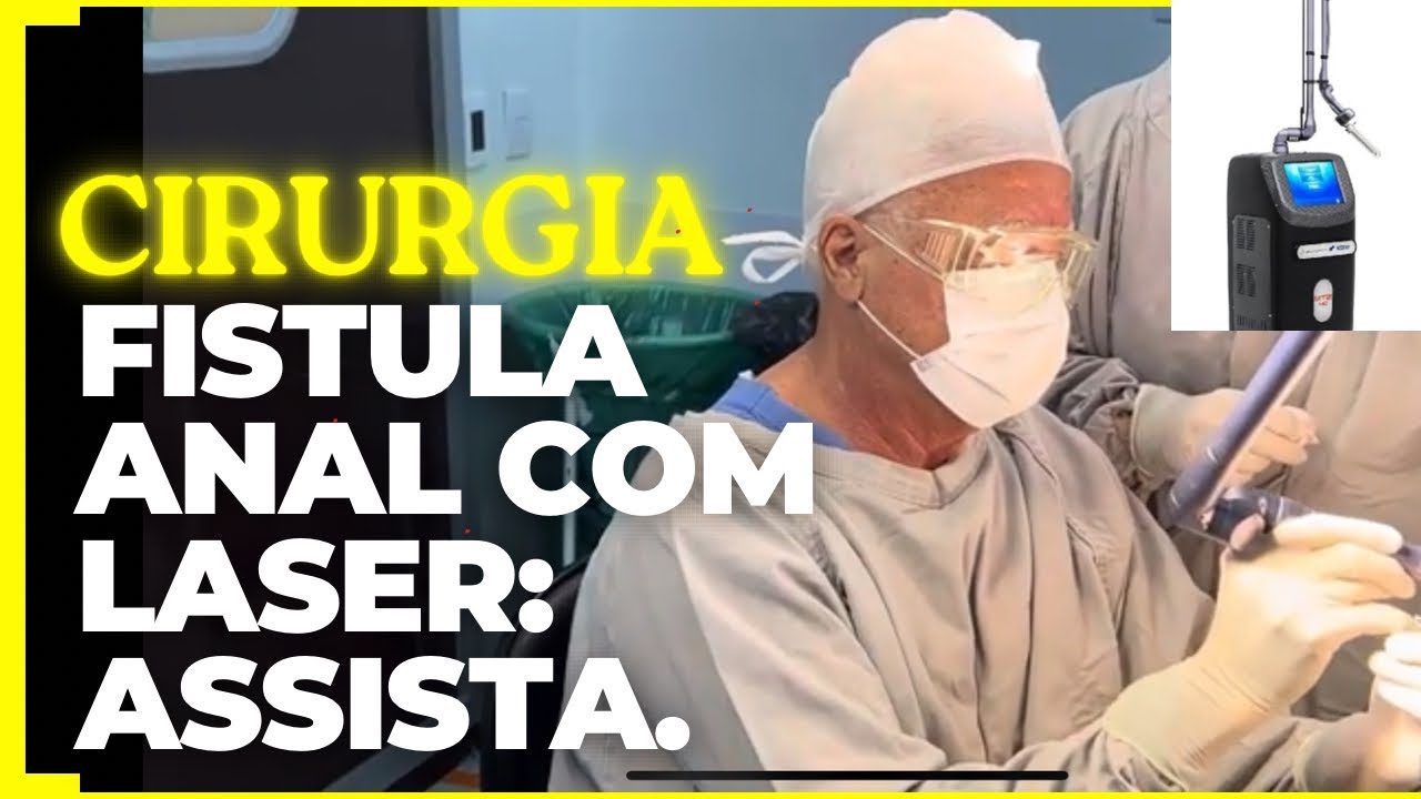 Proctologista Fazendo C Laser Cirurgia P Fístula Anal Anestesia