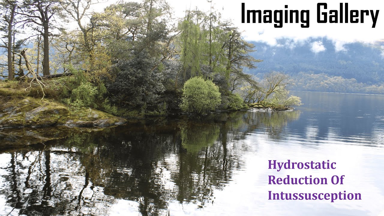 HYDROSTATIC REDUCTION OF INTUSSUSCEPTION - BY DR. ANIL JOSHI. - YouTube