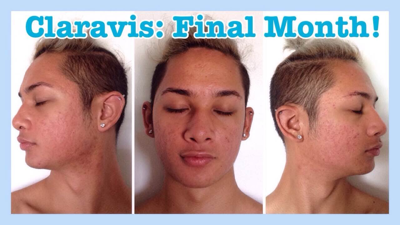 Claravis Month Six - YouTube