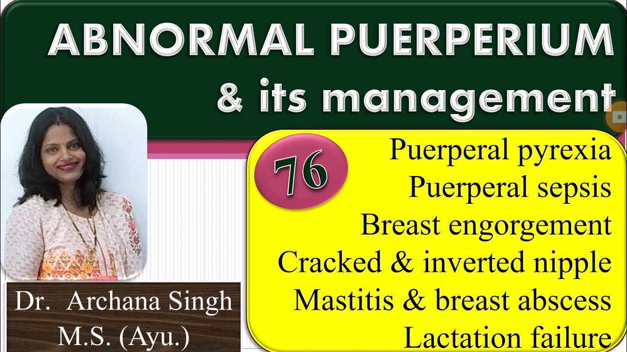 76.ABNORMAL PUERPERIUM & ITS MANAGEMENT- Puerperal Pyrexia & Breast ...