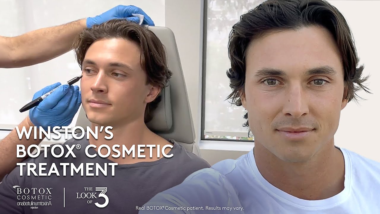 Winston, 25—BOTOX® Cosmetic Treatment Journey - YouTube