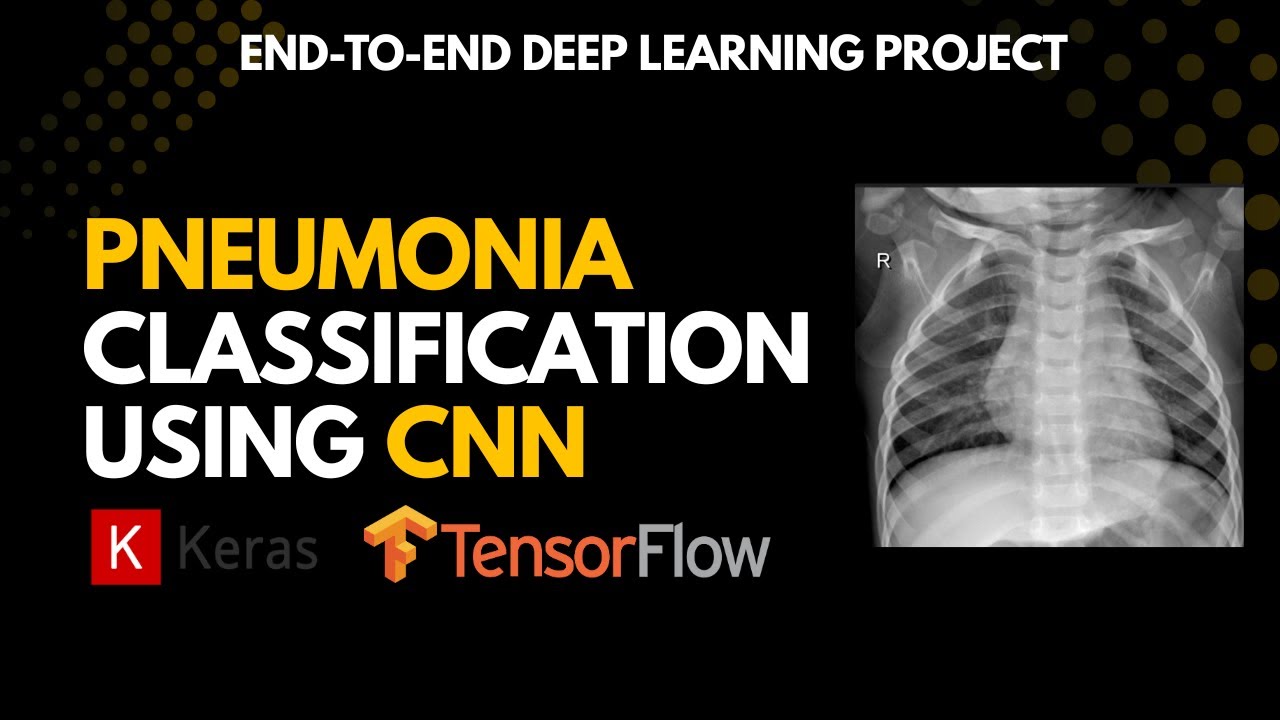 Pneumonia Classification using CNN | End-to-End Deep Learning Project ...
