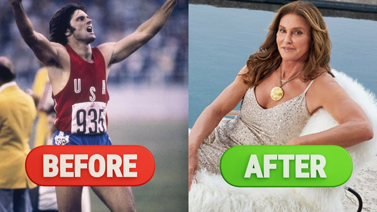 CELEBRITY BEFORE AND AFTER PLASTIC SUERGERY | CAITLYN JENNER - YouTube