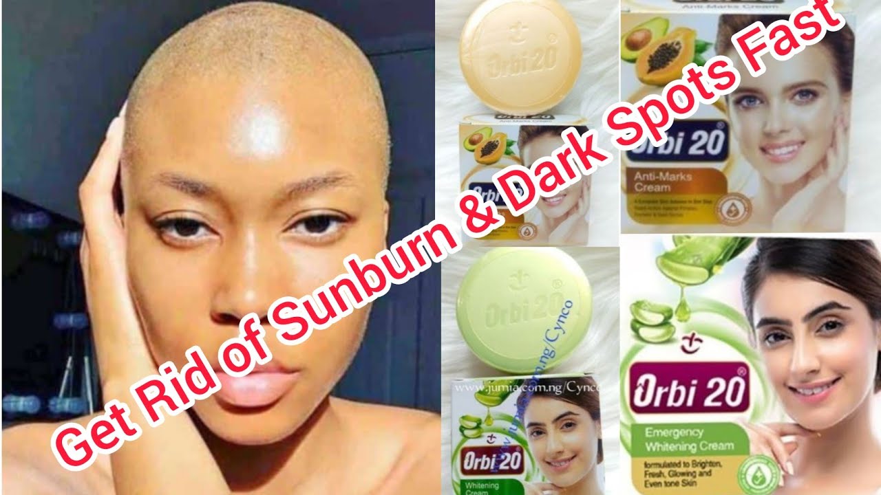 Orbi 20 Anti-Mark Face Cream Review/Clear Sunburn, Dark eyes circle ...