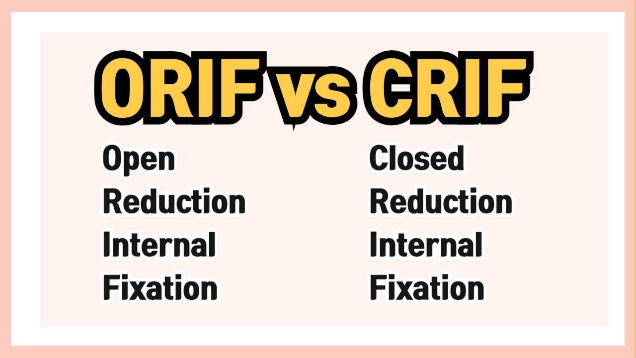 ORIF CIRF 차이점? #신규간호사 #간호 #정형외과 #골절수술 #골절 #뼈수술 #ORIF #CRIF #수술실간호사 #수술실 ...
