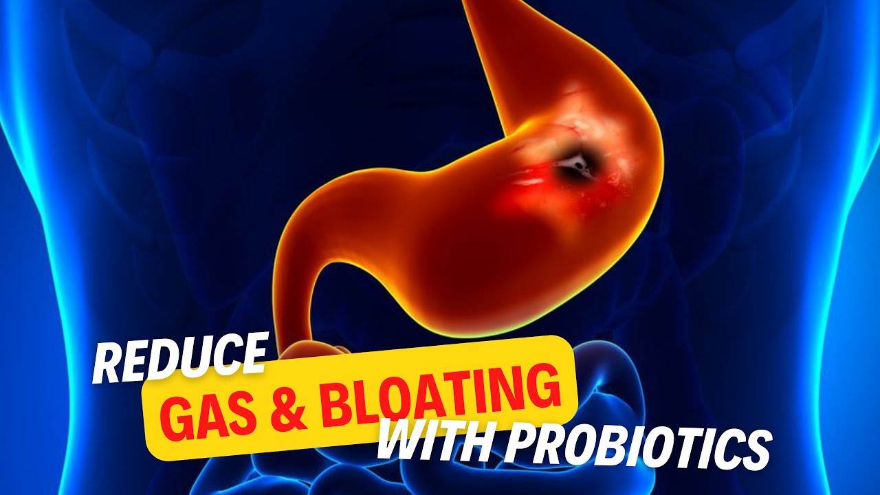 How To Stop Flatulence: Tips for Reducing Farting & Cow Burping - YouTube