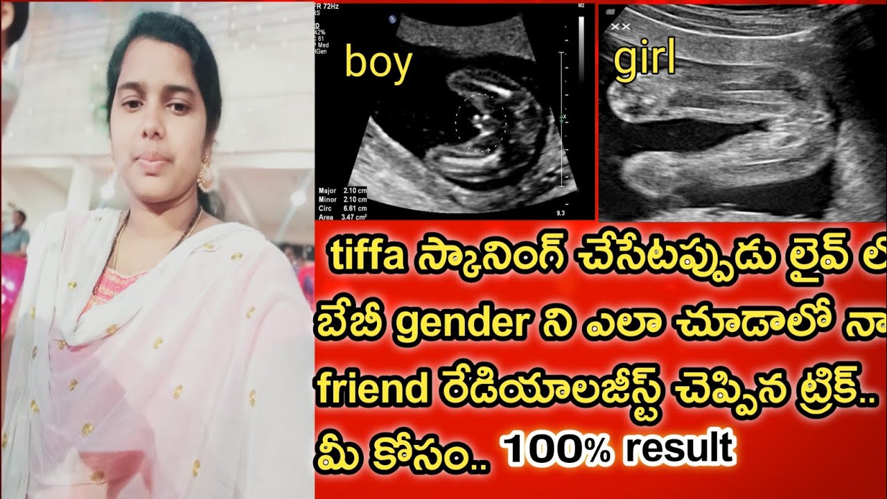 How to know baby gender by Tiffa Scanning #babyboy #babygirl #pregnancy ...
