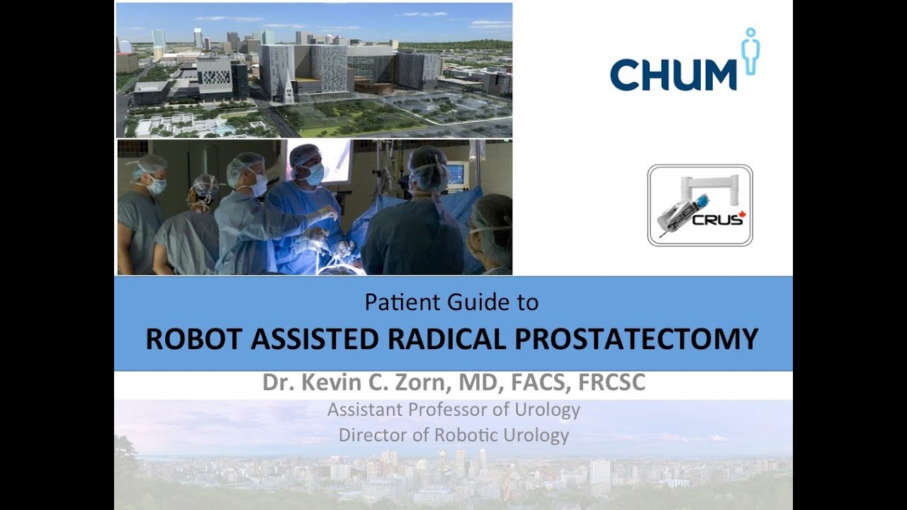 ROBOTIC RADICAL PROSTATECTOMY - RARP- FULL SURGICAL CASE- PATIENT ...