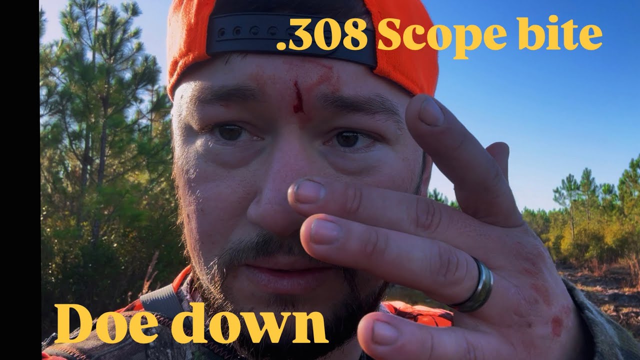 .308 Scope Bite - YouTube