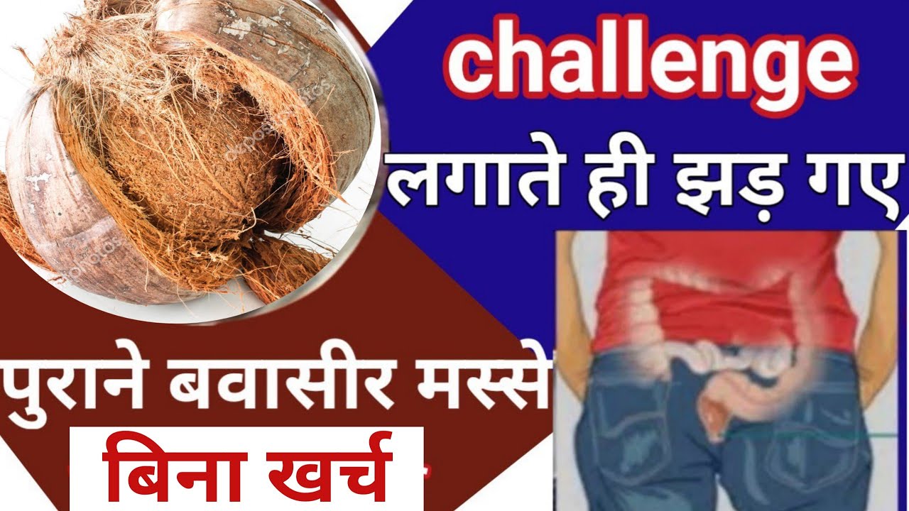 0 खर्च बवासीर जड़ से खत्म| bavasir ki dawa | bawaseer ke masse ka ...