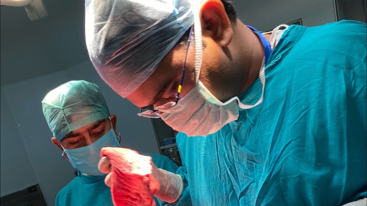 Thoracic Outlet Decompression@Cervical Rib Excision & Anterior ...