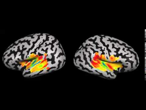 fMRI animation: Cochleotopic mapping of human auditory cortical fields ...